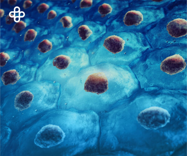 Células madre multipotentes - Centro Médico Eternal