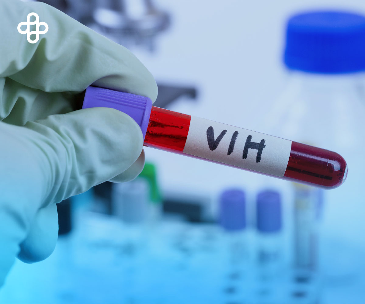 ¿Qué es el VIH SIDA? - Centro Médico Eternal