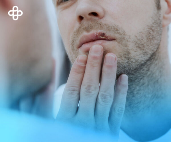 Síntomas del VIH SIDA - Centro Médico Eternal