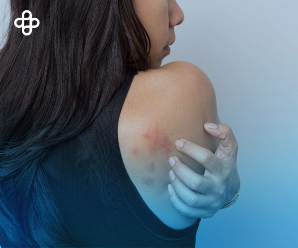 Síntomas del VIH SIDA - Centro Médico Eternal